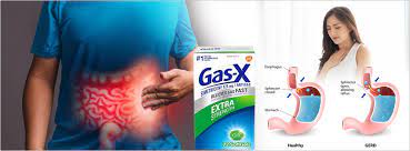 Understanding Gas-X Side Effects: What You Need to Know