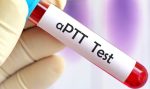 Mastering the APTT Test: Guide to Clotting Health Assessment