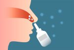 How to Use Flonase: Guide for Effective Allergy Relief