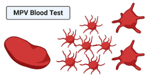 Low MPV Blood Test: Causes, Symptoms, and Management