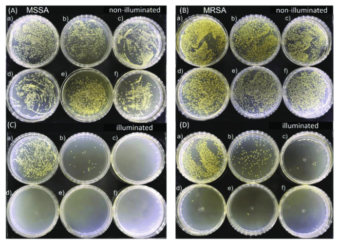 Mssa Infections Understanding Methicillin Sensitive Staphylococcus Aureus