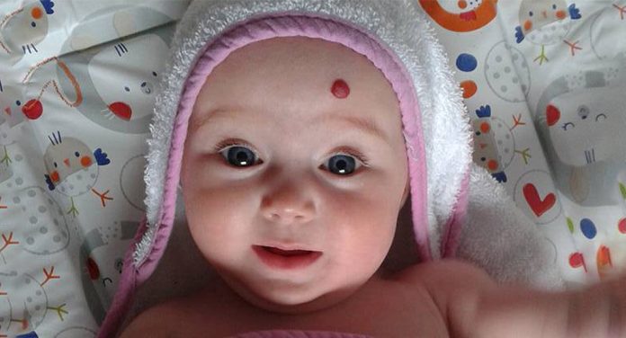 Strawberry Birthmarks: Causes, Types, and Treatment