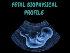 Demystifying the Biophysical Profile: A Window Into Fetal Health