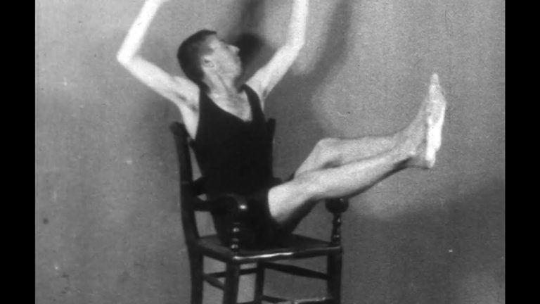 Catatonic Schizophrenia