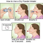 Mastering Inhaler Technique A Step-by-Step Guide
