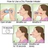 Mastering Inhaler Technique A Step-by-Step Guide