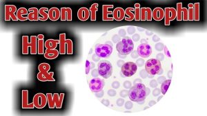 Low Eosinophils: Causes, Symptoms, and Treatment Options