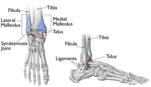 The Ankle Malleolus A Crucial Anatomy Lesson