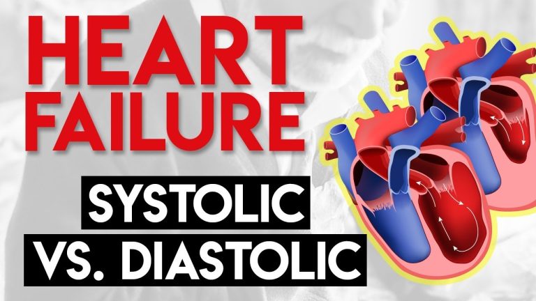Systolic Heart Failure Causes, Symptoms, and Management