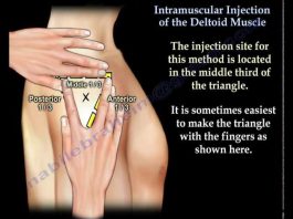 Mastering Intramuscular Injections, Painless and Effective
