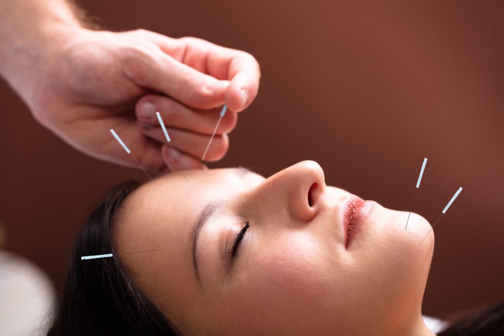 The Healing Power, Top 10 Benefits of Acupuncture